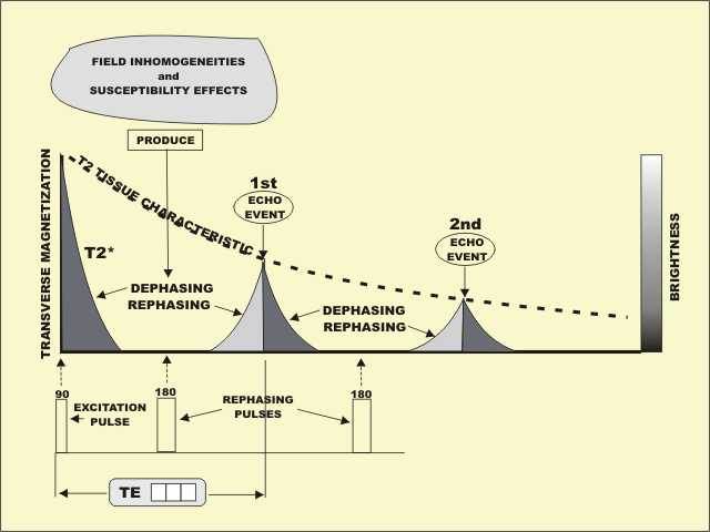 Magnetic Resonance Imaging